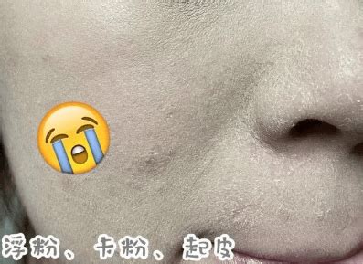 皮肤干燥缺水常见的表现有哪些 伊的家