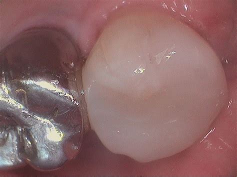 THE BIOCLEAR MATRIX SYSTEM Maribel M Vann DDS