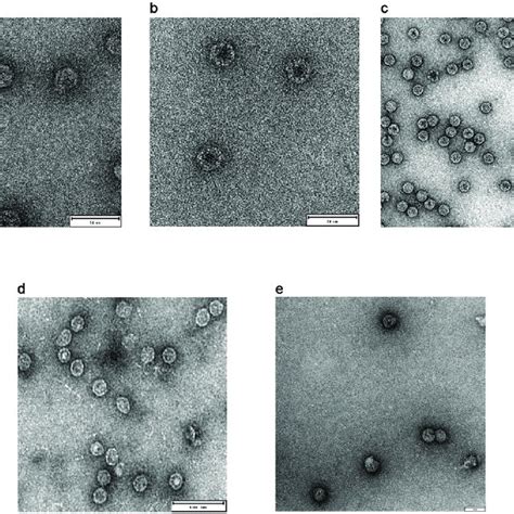 Negative Staining Transmission Electron Microscopy Nstem Analysis Of