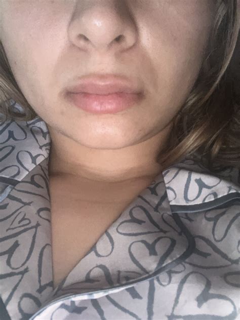 의사에게 물어보세요 안녕하세요 저는 강남언니 1등 성형수술and피부시술 정보앱