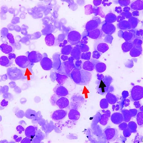 Pdf Oral Plasmacytoma In A Dog