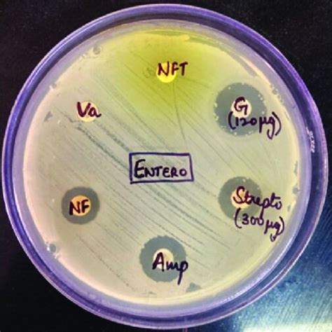 Antibiotic Susceptibility Test Kirby Bauer Disk Diffusion Method
