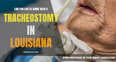 Can You Safely Shower With A Tracheostomy Tips And Precautions To Follow Medshun