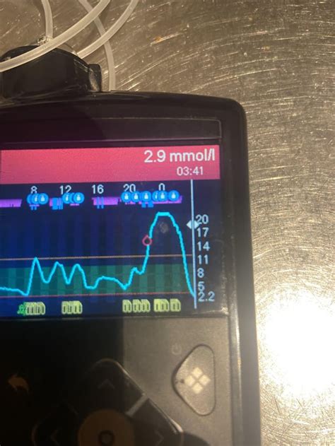 What Is Going On At Romnipod And With The Omnipod 5 Rdiabetest1