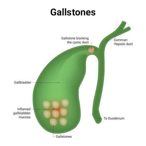 Gallbladde Images Free Download On Freepik