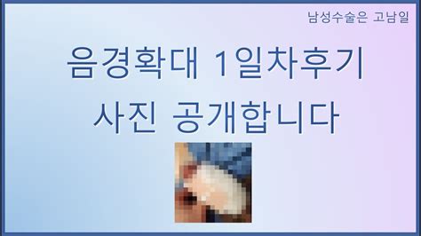 음경확대수술후기 1일차 남성수술 고남일 Youtube