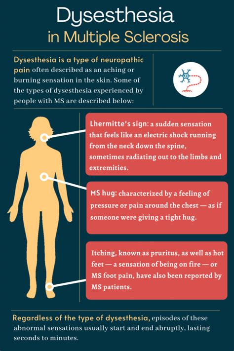 Multiple Sclerosis