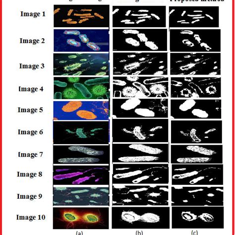 Segmented Microscopic Image By A Original Image B Segmented Image By