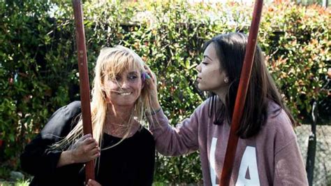 What Is Systemic Sclerosis More Than Scleroderma