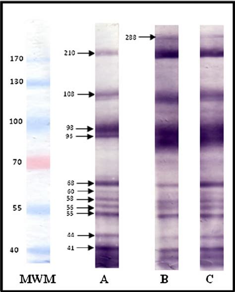 Lectin Blotting Of Glycoproteins Of N Fowleri Eluted From G Nivalis Download Scientific