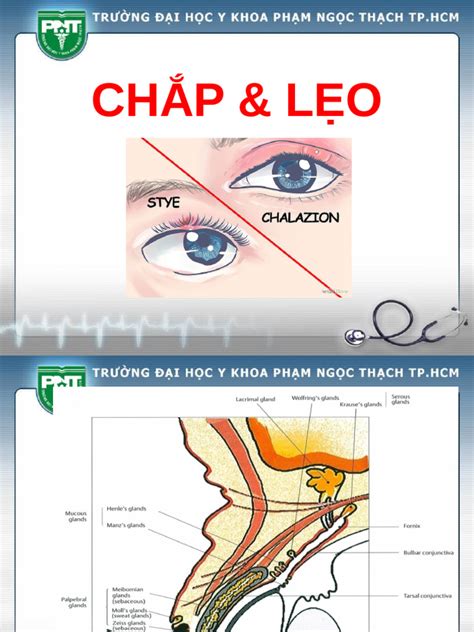 ChẮp LẸo Pdf