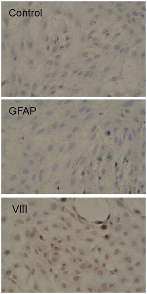 Expression Of Viii And Gfap Viii And Gfap Expression Were Detected By