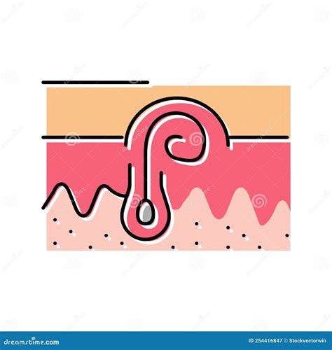 Ingrown Hair Color Icon Vector Illustration Stock Vector Illustration