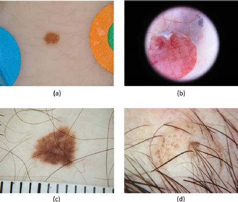 Figure 1 From U Net Based Network Applied To Skin Lesion Segmentation
