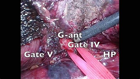 Sgo Iasgo Video Articles