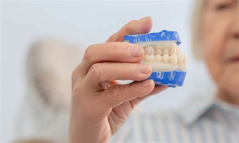 Denture Stomatitis Denture Hygiene Why When And How