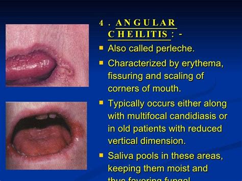 Bacterial Viral And Mycotic Infections Bacterial Viral And Mycotic Infections