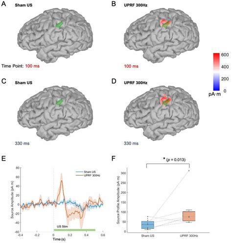 Eeg Spatiotemporal Responses At The Source Domain A D The Esi