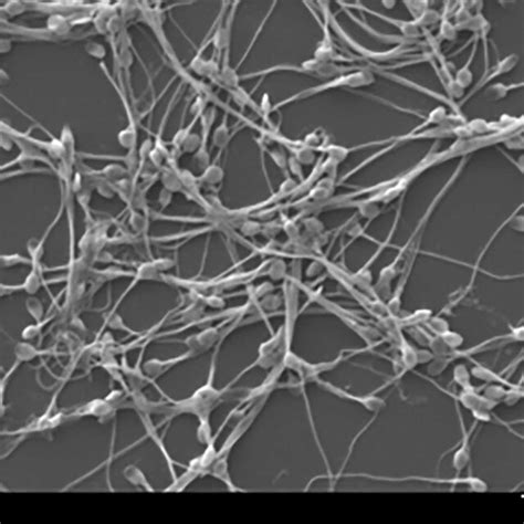 Scanning Electron Micrograph Showing Agglutination Of Hcatreated Washed Download Scientific