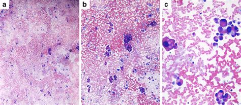 In The Fnac Slides Were Observed Samples With Moderate Cellu Larity Download Scientific