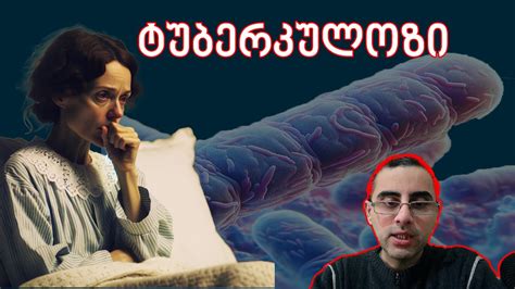 ტუბერკულოზი ნიშნები სიმპტომები მკურნალობა ვაქცინა Youtube