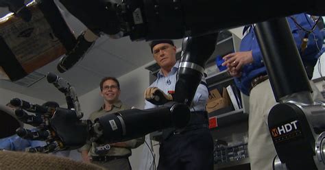 How A Robot Named Robo Sally Could Save Soldiers Limbs Cbs News