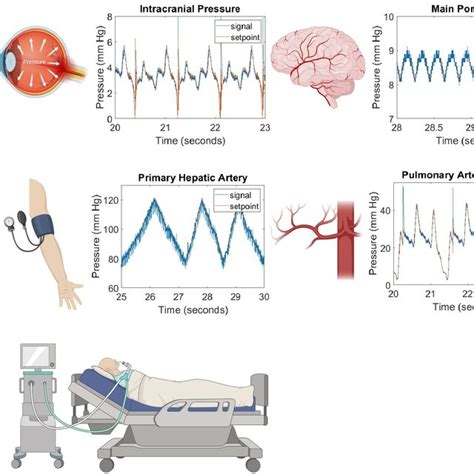 Patient Waveforms Derived From Clinical Databases And Journal Articles Download Scientific