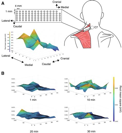 Electrode Placement And Color Map Of The Representative High Density Download Scientific