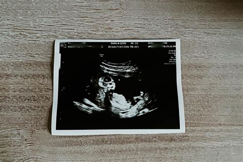 Does Peyton Meyer Have A Son The Us Sun