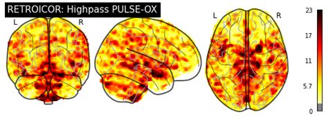 Tutorial 4 Regressors From Pulse Oximeter Data Niphlem 0 0 1 Beta