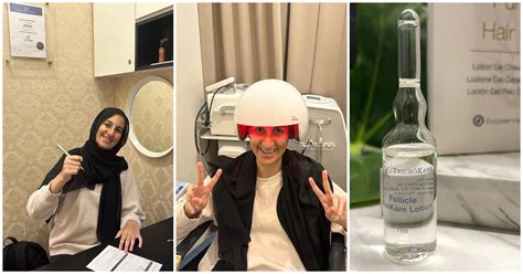 REVIEW Can Save My Badly Damaged Scalp After Impulsively Dyeing My