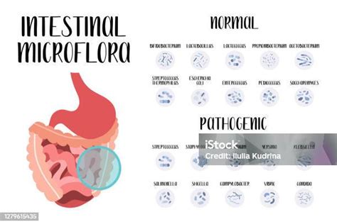 장 내 미생물 위장 창 자 창 자에 대 한 정상 및 병원 성 박테리아 좋은 나쁜 미생물 미생물군유전체 벡터 플랫 만화 일러스트레이션 전단지 의료 브로셔 배너에 적합 아구창에
