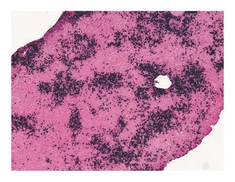 Kappa A And Lambda B MRNA By In Situ Hybridization Showing Download Scientific Diagram