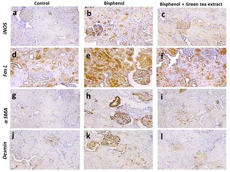 Representative Immunostaining Of Rats Renal Cortex Of The Different