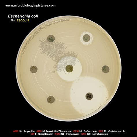 Escherichia Coli Susceptible To Fosfomycin And Nitrofurantoin