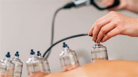 Cupping Therapy Treatment How It Works And Benefits Cupcure