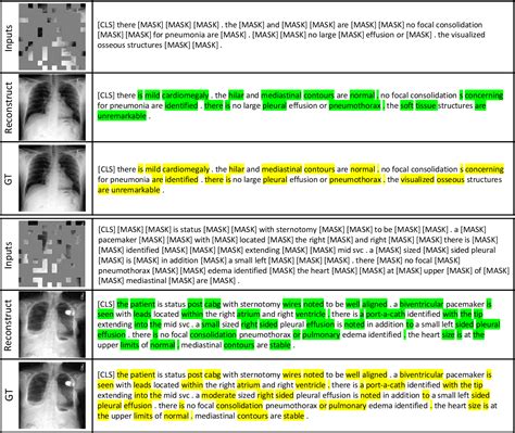 Figure 4 From Multi Task Paired Masking With Alignment Modeling For Medical Vision Language Pre