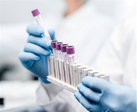 Cmc Analytical Support For Cgmp Biologics Manufacturing Scorpion Biological Services Usa