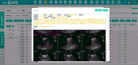 b s架构saas模式 医院云his系统源码，自主研发，支持电子病历4级 医疗软件bs架构 csdn博客