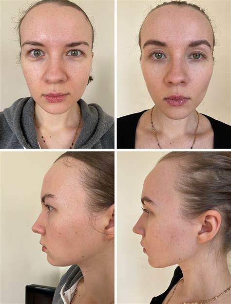 I Tried An At Home Microcurrent Device For 30 Days Heres 47 Off