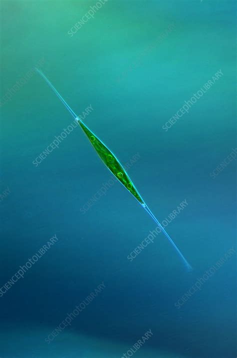 Closterium Desmid Light Micrograph Stock Image C0258911 Science