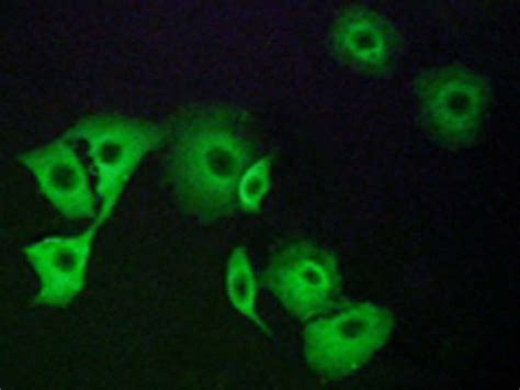 兔抗foxe1多克隆抗体anti Foxe1 Rabbit Polyclonal Antibody 生命科学产品与技术服务 生工生物工程