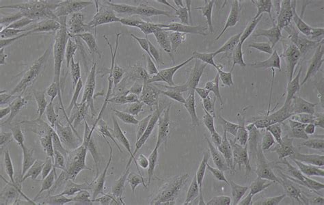 Ipsc Generation Ipsc21 Induced Pluripotent Stem Cells