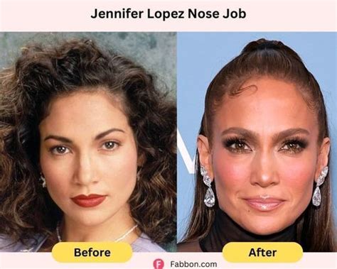 Jennifer Lopez Before And After Nose Job