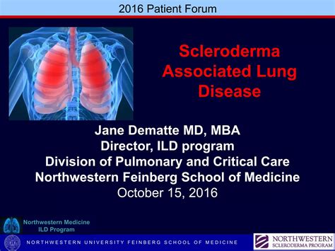 Scleroderma Associated Lung Disease Pptx