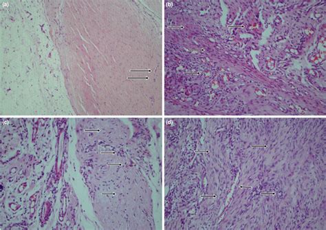 Histopathological Views Of Each Group A Only Mild Neovascularization Download Scientific