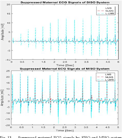 figure 1 from non invasive extraction of fetal and maternal ecg signals