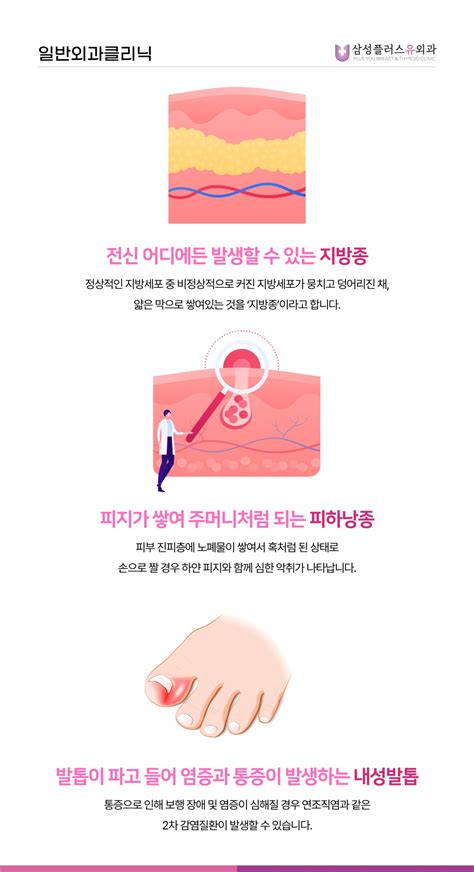 일반외과클리닉 삼성플러스유외과