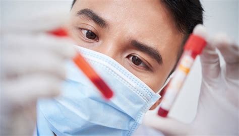 Prothrombin Time Test Fungsi Prosedur Dan Cara Baca Hasil Mandaya