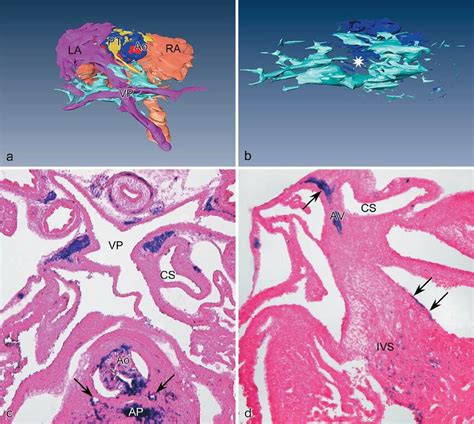 A D Three Dimensional Reconstructions Based On Serial Sections Of A Download Scientific Diagram